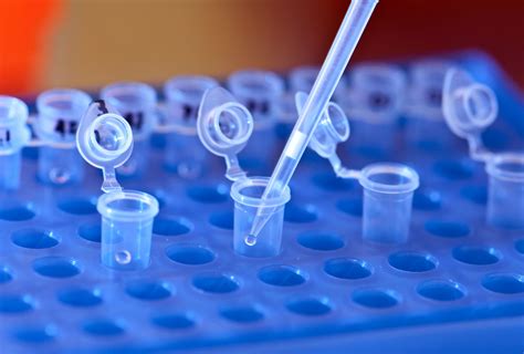 Ivermectin And Doxycycline LiMSforum The Global Laboratory Informatics Medical And