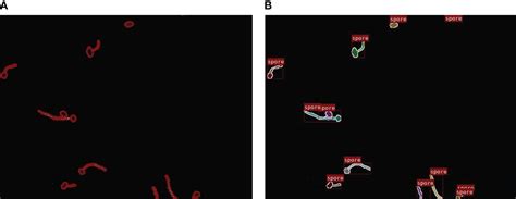 Frontiers A Deep Semantic Network Based Image Segmentation Of Soybean Rust Pathogens