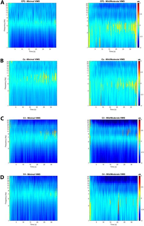 Ersps Across The A Right Centro Parietal Cp2 B Midline Central Cz