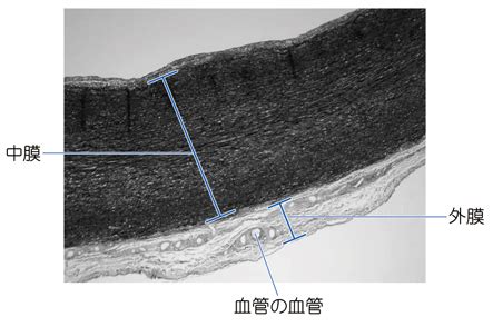 18101890 脈管系の組織 CBT M3E Medical