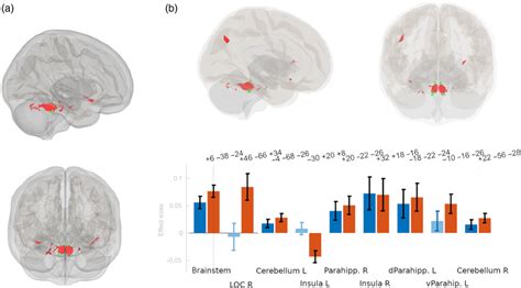 Baseline Findings Of Localisationbased LC Functional Connectivity To Download Scientific
