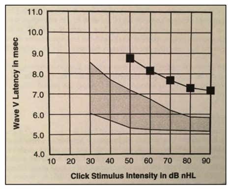 Electrophysiology Quiz 2 Threshold Abr Interpretation Flashcards Quizlet