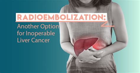 Radioembolization For Liver Cancer Uva Radiology