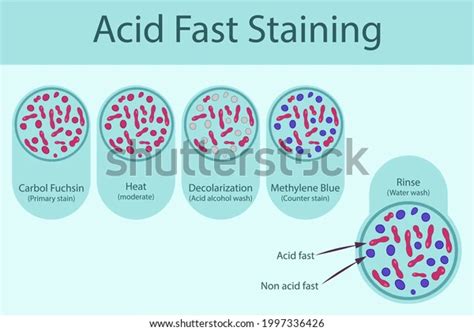 Acid Fast Staining Technique Steps Diagram
