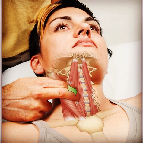 Longus Capitis Trigger Points