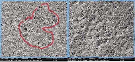 Example Of Etching Pattern Types Iii Red And Iv Blue Found In Group A Download Scientific