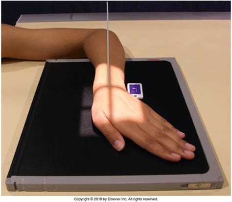 Scaphoid Flashcards Quizlet