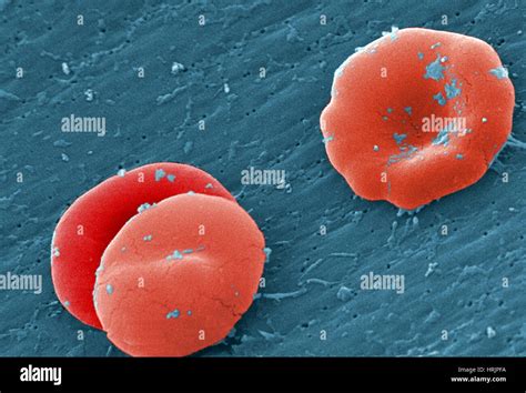 Emoglobina Fetale Immagini E Fotografie Stock Ad Alta Risoluzione Alamy