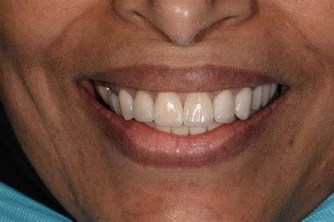 حالات تم علاجها عيادات جذور الاسنان