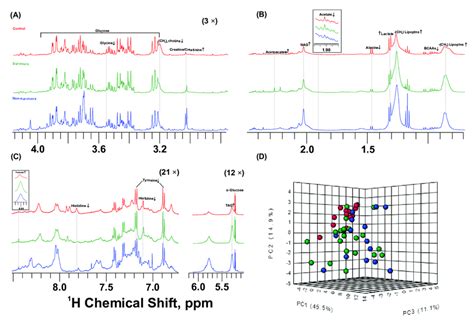 1 H Nmr Based Metabolomics Shows Different Plasma Metabolite Profiling Download Scientific