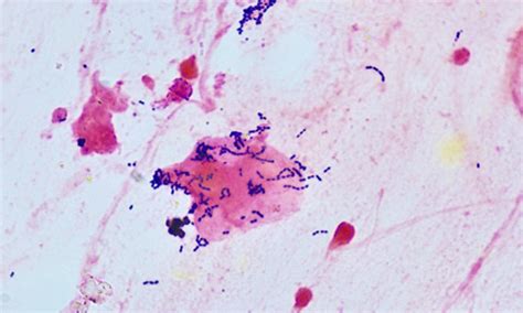 Streptococcus Drug Discovery World Ddw