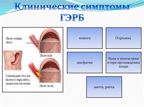 Патология желудочно кишечного тракта презентация онлайн