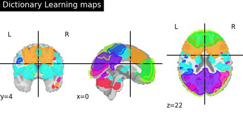 Regions Extraction Using Dictionary Learning And Functional Connectomes Nilearn