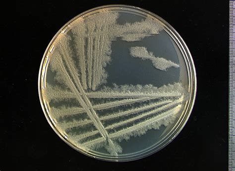 Bacillus Mycoides Alchetron The Free Social Encyclopedia