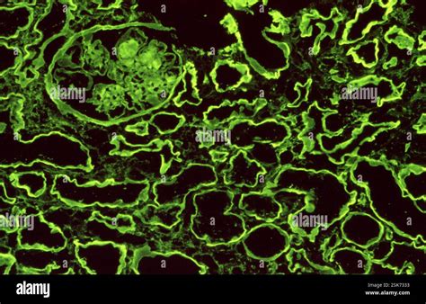 Stroke CT Brain Scan Stock Photo Alamy
