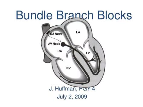 PPT Bundle Branch Blocks PowerPoint Presentation Free Download ID 4807495