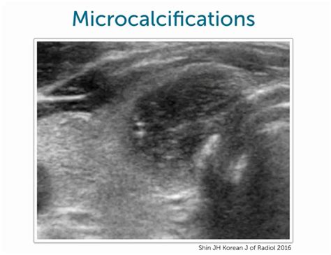 Thyroid Us Masterclass 123sonography