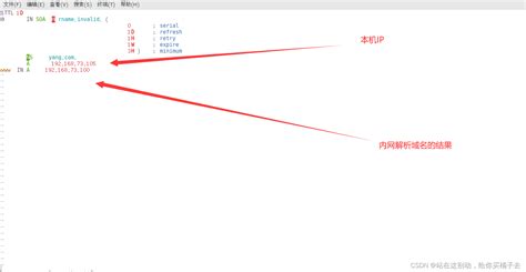 Linux中DNS的分离解析和自动分配 linux动态dns获取 CSDN博客