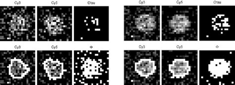 Figure 1 From Segmentation Of Cdna Microarray Spots Using Markov Random Field Modeling