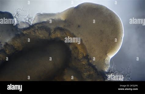 Colony Bacteria Stock Videos And Footage Hd And 4k Video Clips Alamy