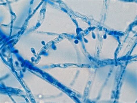 Fun With Microbiology Whats Buggin You Trichophyton Rubrum