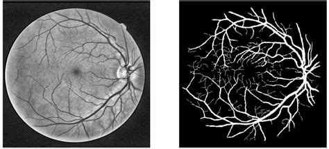 Building Computer Vision And Ml Models Legiit