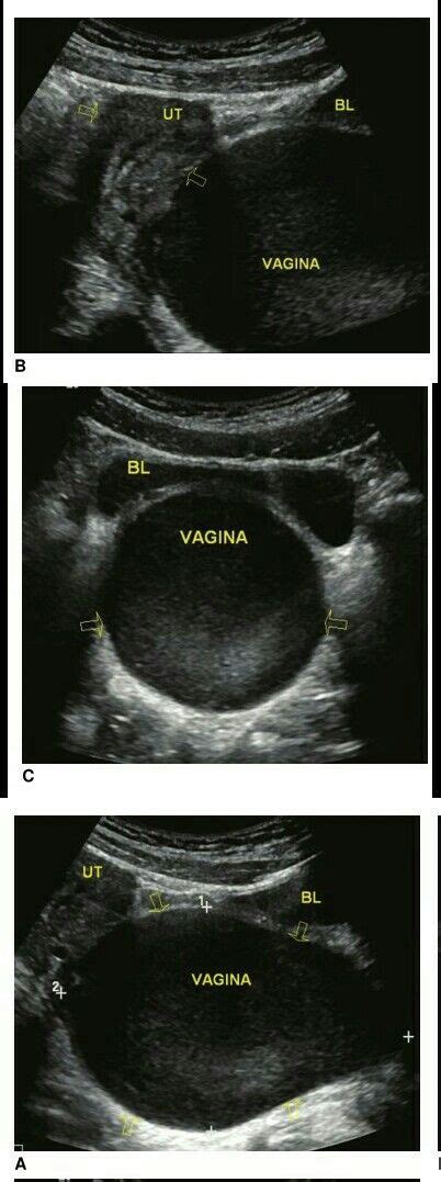 Pinterest Ultrasound Sonography Medical Ultrasound Ultrasound Technician