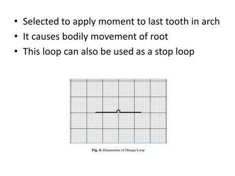Loops In Orthodontics T Loop Bull Loop Vertical Loop Mushroom Loop Stop