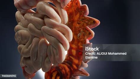 인간의 소화 시스템의 해부학 장의 개념 게실염 3d 렌더링 셀리악병에 대한 스톡 사진 및 기타 이미지 셀리악병 질병 창자 Istock