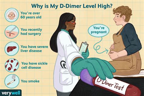 D Dimer Test What It Is Testing And Results