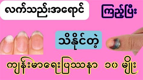 လက်သည်းအရောင်ကပြောပြနေတဲ့ ကျန်းမာရေးပြဿနာ ၁၀ မျိုး Youtube