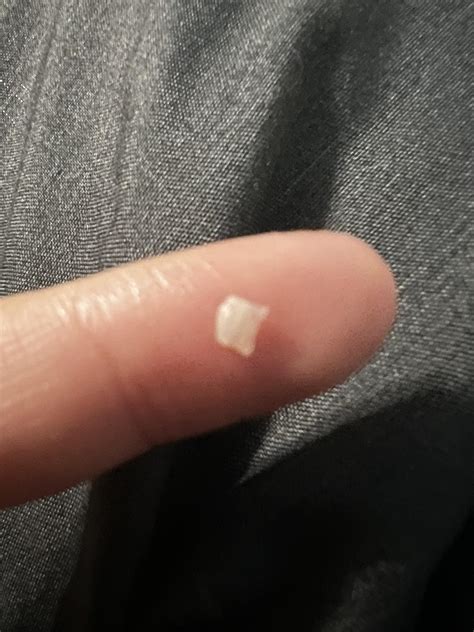 Piece Of Tooth Growing Out Of Gum Fell Out It Never Fully Grown And It Was Growing Under A
