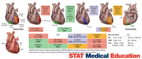 Relationship Of 12 Lead Ecg To Coronary Artery Anatomy Ecg