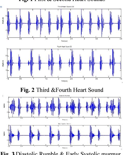 Figure 1 From Detection Of Pathological Heart Murmurs By Feature Extraction Of Phonocardiogram