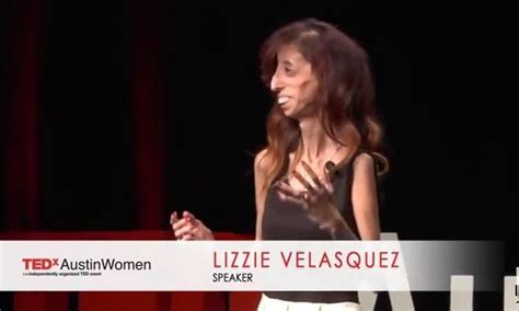 What Defines You Tedx Austin Lizzie Velasquez Lizzie Velásquez