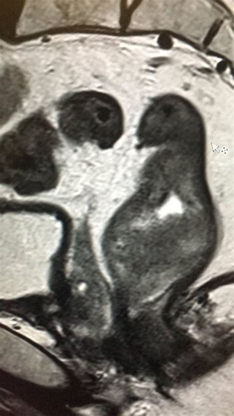 Bilal Albayrak On Linkedin Mri Articticmri Sanatsal