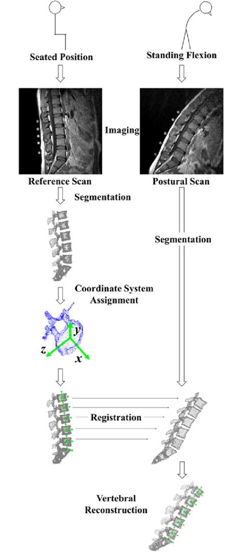 Workflow Used To Reconstruct Vertebrae From Postural Scans With Quality Download Scientific