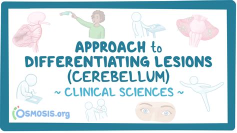 Approach To Differentiating Lesions Cerebellum Video And Meaning Osmosis