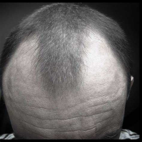 Common Hair Problems Appearance