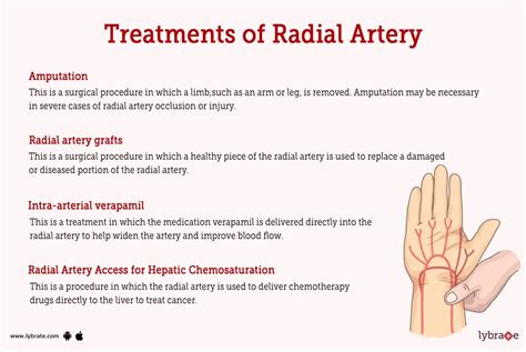 Radial Artery Human Anatomy Image Functions Diseases And Treatments