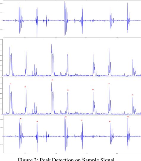 Figure 3 From Heart Sounds Segmentation And Classification Using Adaptive Learning Neural
