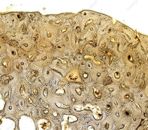 Bone Light Micrograph Stock Image C024 8144 Science Photo Library