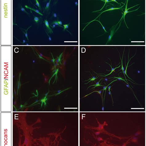 Phenotypic And Morphological Characterization Of Activated Astrocytes Download Scientific