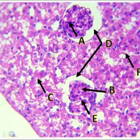 renal cortex a cell pool in glomerulus b glomerular atrophy c