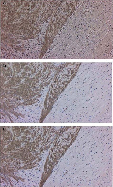 Improved 1 H Rapid Immunostaining Method Using Intermittent Microwave Irradiation