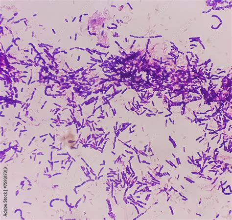 Yeast Infection Budding Yeast And Pseudohyphae Of Candida Albicans Grams Stain This Fungus