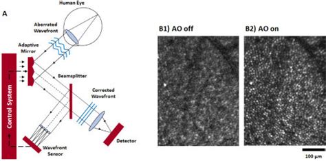 Adaptive Optics Ophthalmoscopy A Schematic Of Aberration Measurement Download Scientific