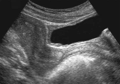 Chapter 41 Procedures Flashcards Quizlet