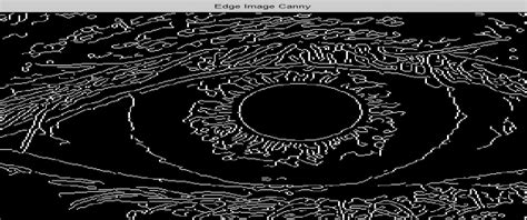 6 Detection Of Edges Using Canny Edge Detector Download Scientific Diagram