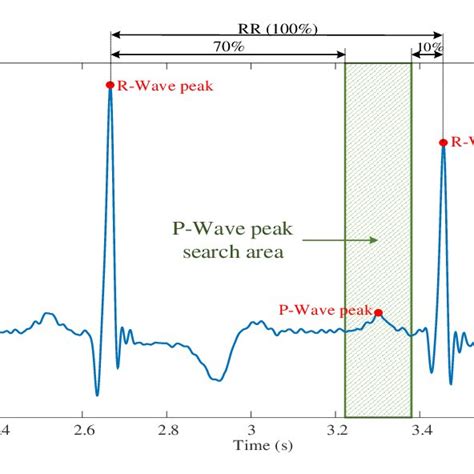 PDF Methodology For Detection Of Paroxysmal Atrial Fibrillation Based